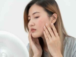 How to Remove White Patches on the Face: Proven Solutions!