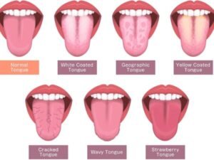 What Tongue Color Says About Your Health: A Visual Guide to Your Body's ...